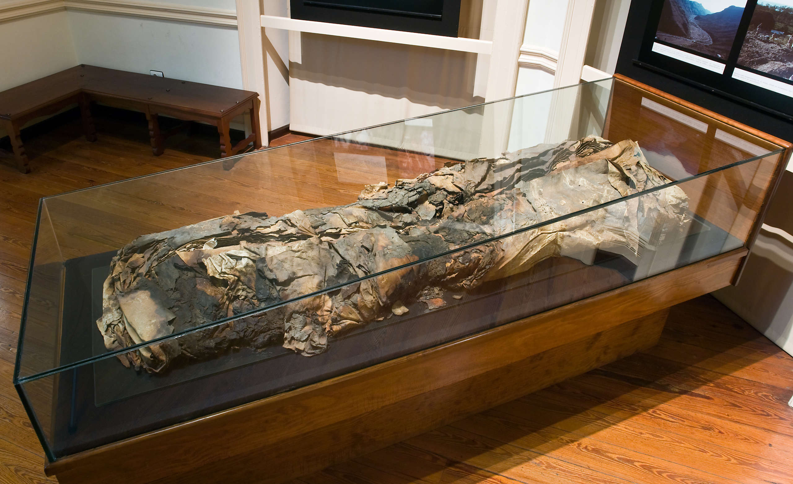 La preparación del cadáver – El Museo canario